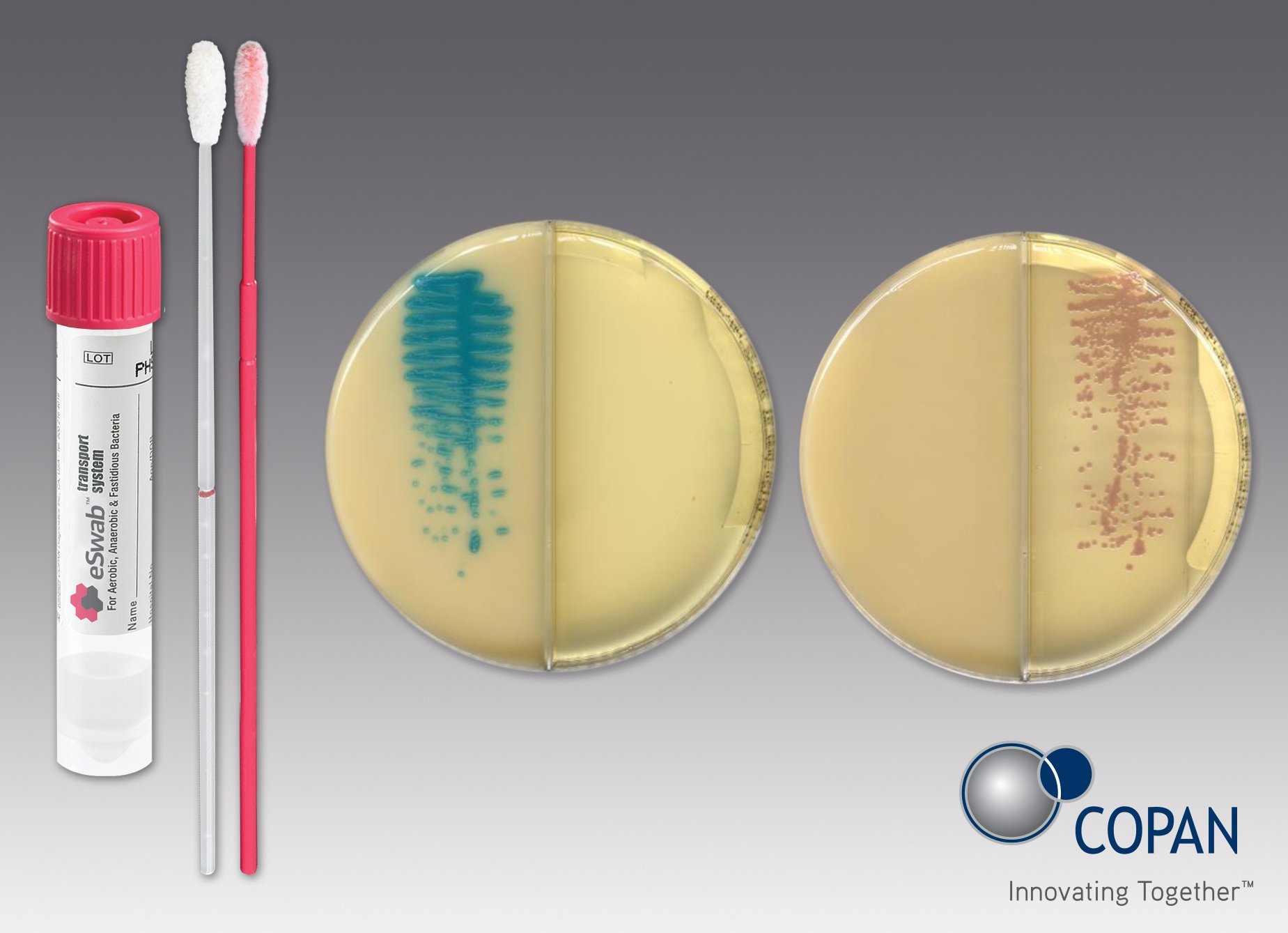 Chromogenic Bi-Plates and Dual ESwab™ Processed on WASPLab® Cuts Number ...