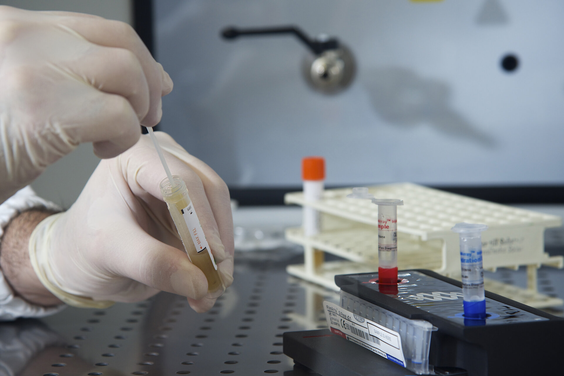 FecalSwab® FAQ | COPAN