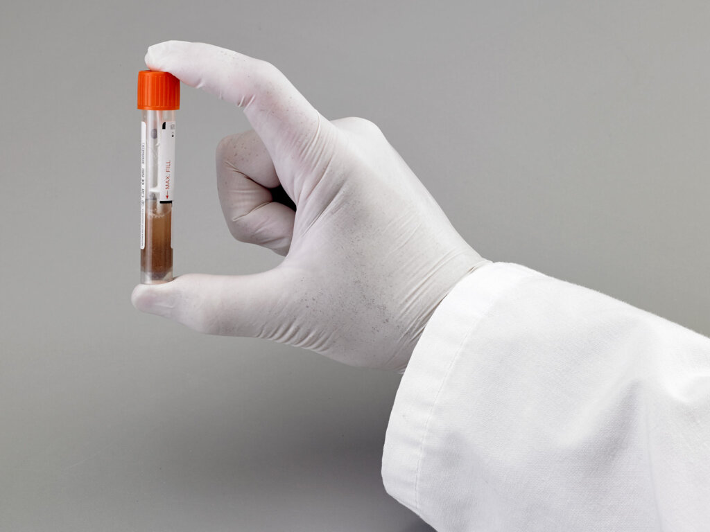 FecalSwab® FAQ | COPAN