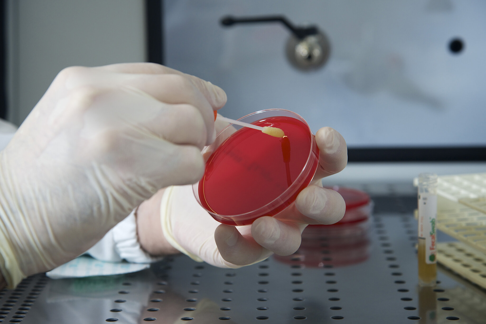 FecalSwab® FAQ | COPAN