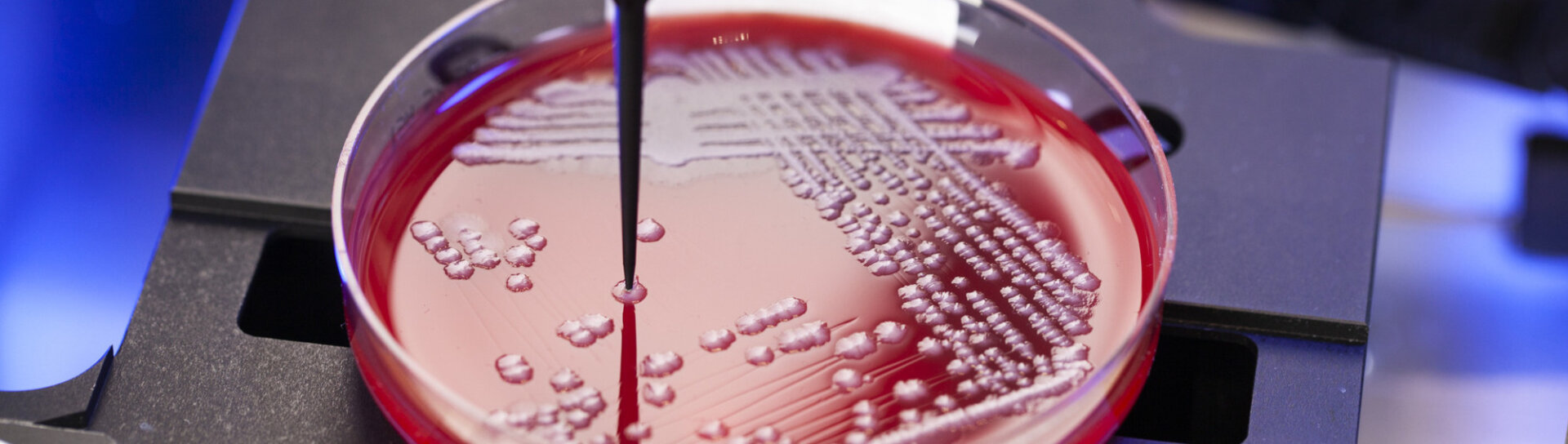 Copan Colibrí™ Receives Third FDA Clearance, Further Expanding ...