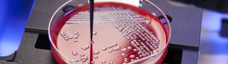 Microbiology Automation and AI | COPAN