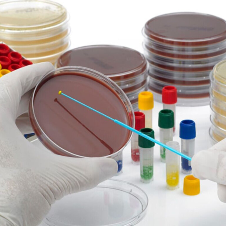 CRYOBANK™ Bacterial Culture Freezing System | COPAN