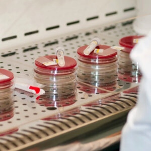 ESwab® Liquid Based Collection and Transport | COPAN