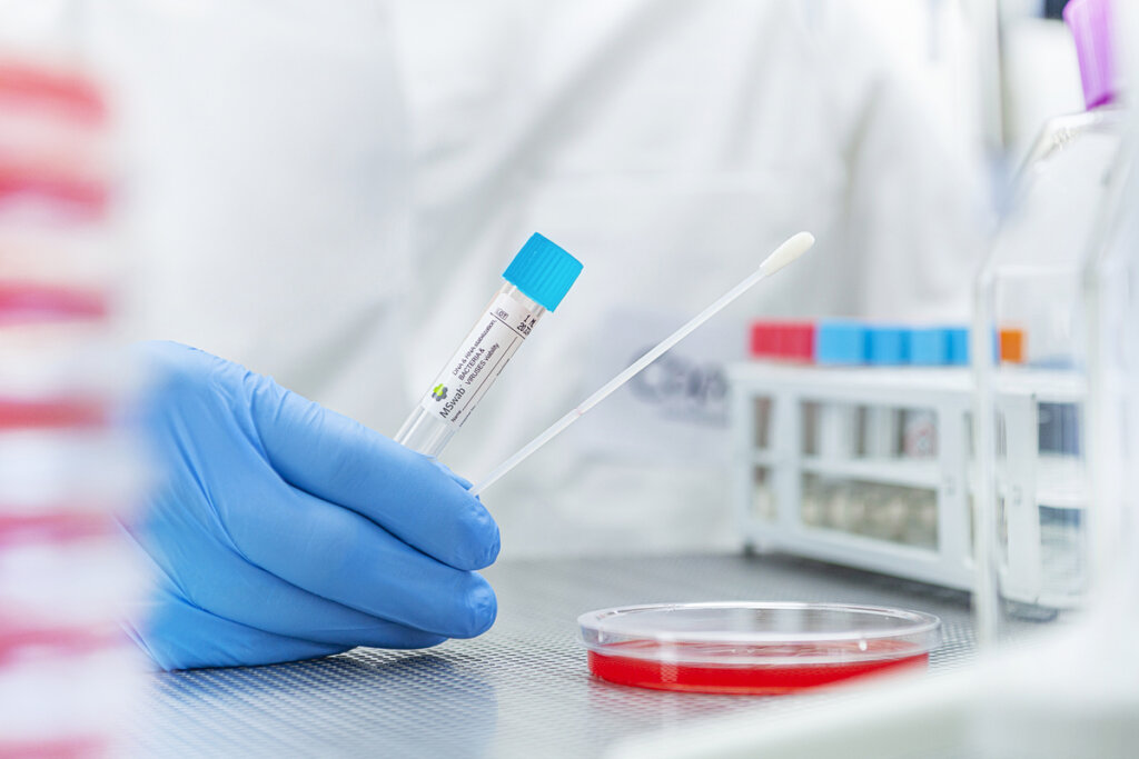 MSwab® System for Molecular Assays | COPAN