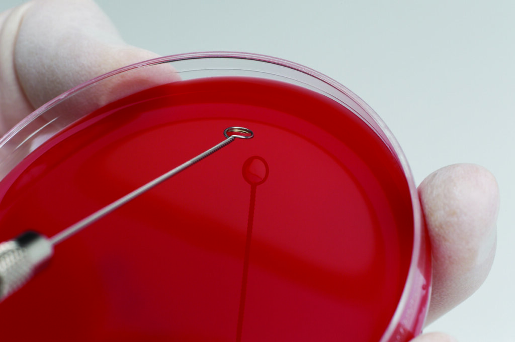 Nickel-Chrome (NiChrome) Wire Loops | COPAN