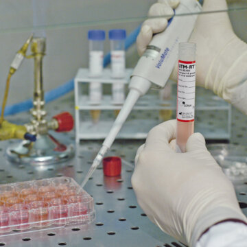 UTM® Universal Transport Medium™ | COPAN