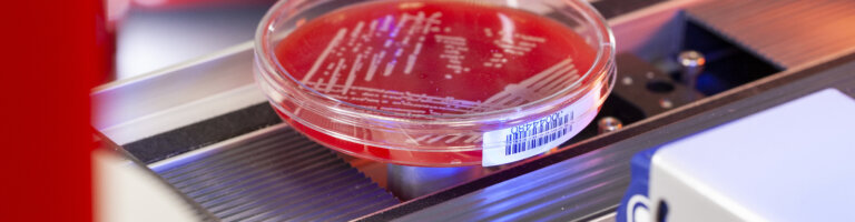 Microbiology Automation and AI | COPAN