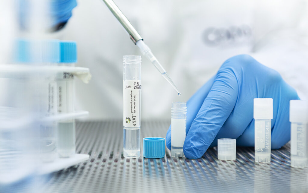 Sample Collection & Transport Kits | COPAN