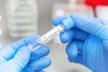 Discover eNAT®: Sample Collection and Transport for Nucleic Acid ...