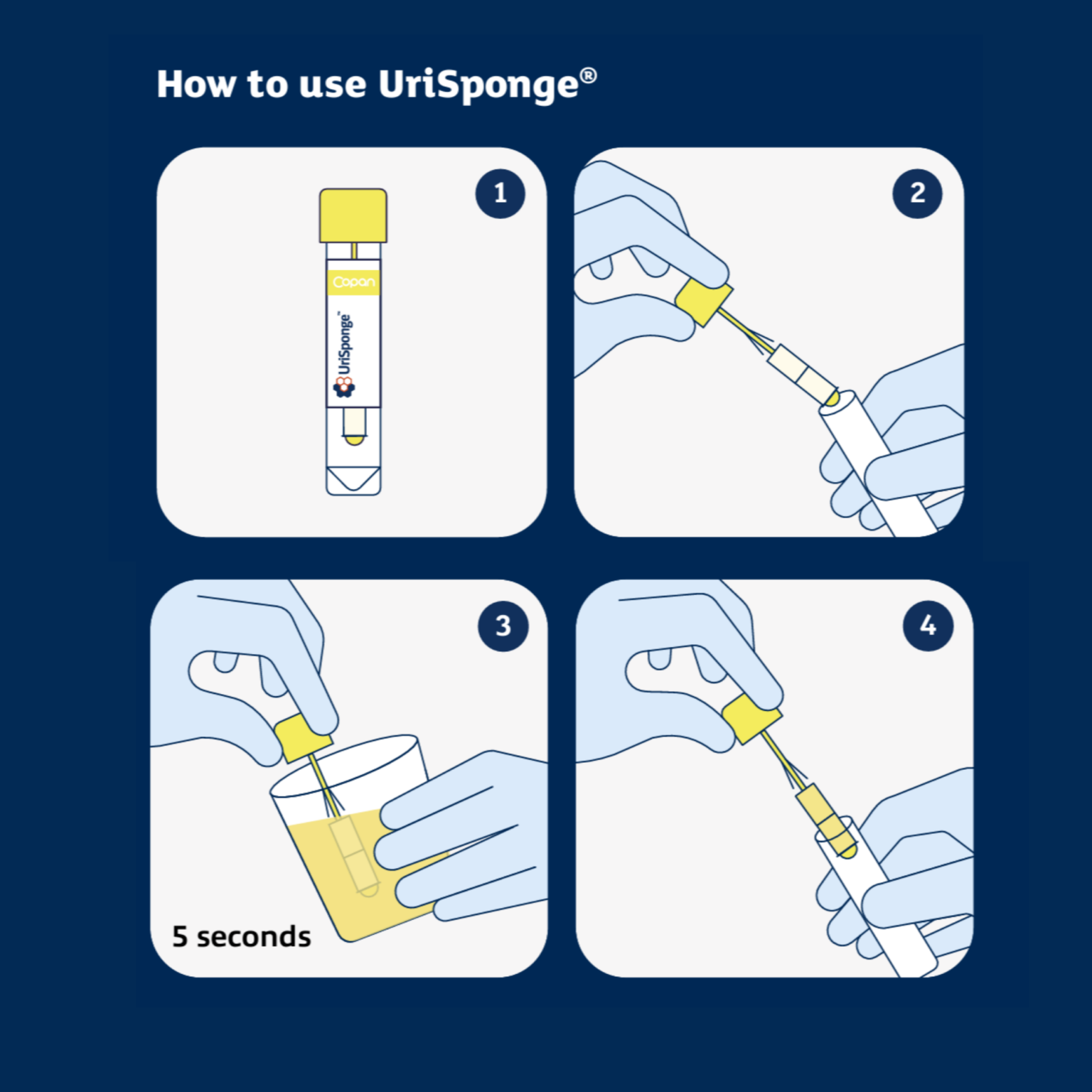 UriSponge® FAQ | COPAN