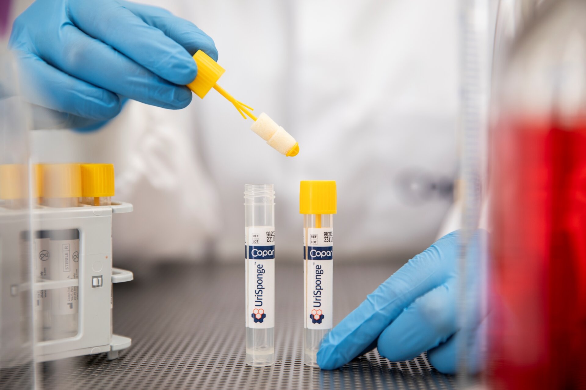 UriSponge® FAQ | COPAN