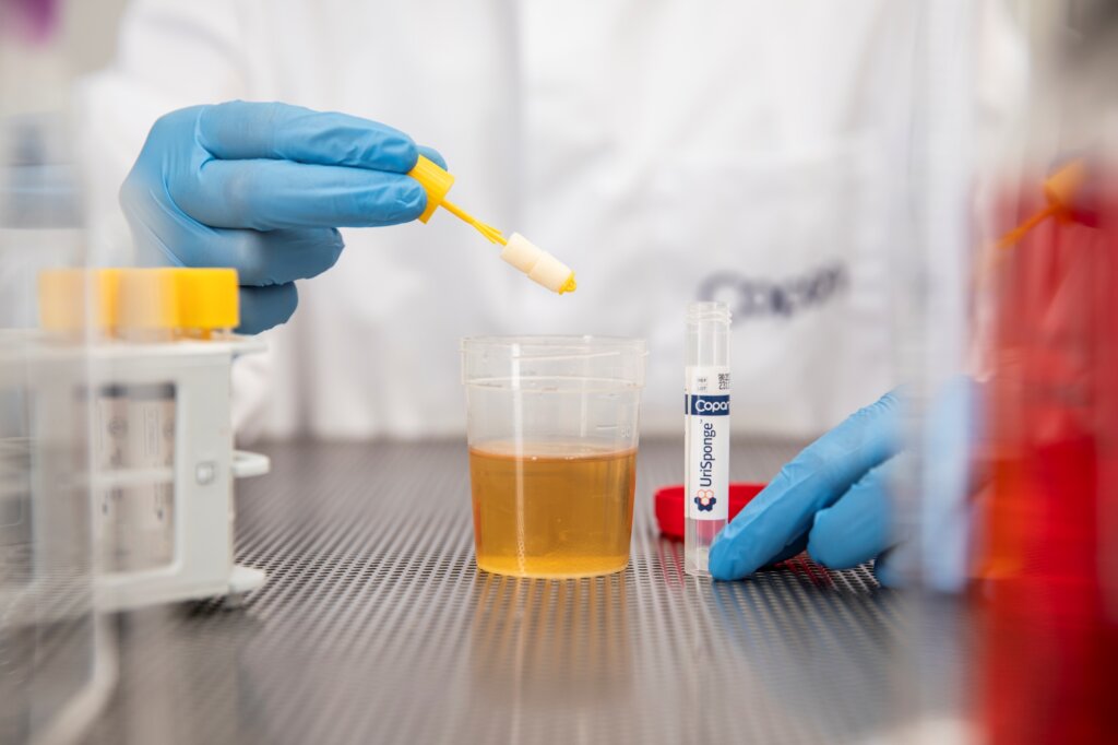 UriSponge® FAQ | COPAN