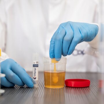 UriSponge® System for Urine Specimens | COPAN