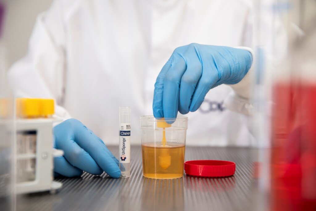 UriSponge® System for Urine Specimens | COPAN